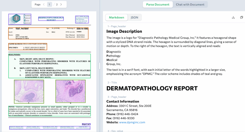 OCR to Agentic Document Extraction: A look into the Evolution of ...